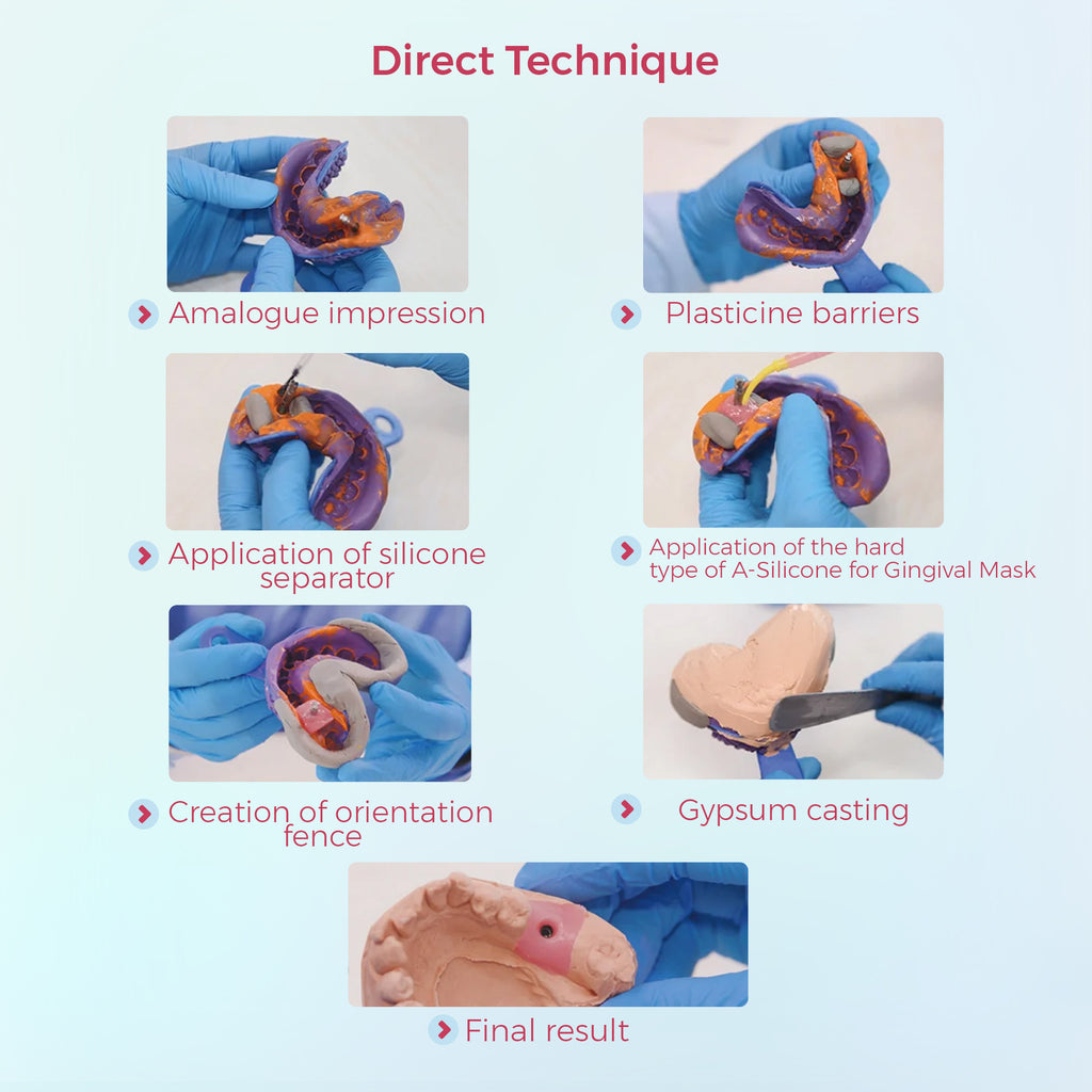 Waldent FlexiGum Gingival Mask – Waldent.com