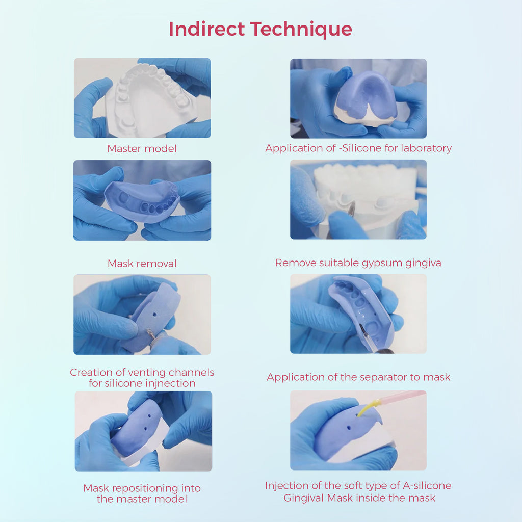 Waldent FlexiGum Gingival Mask – Waldent.com