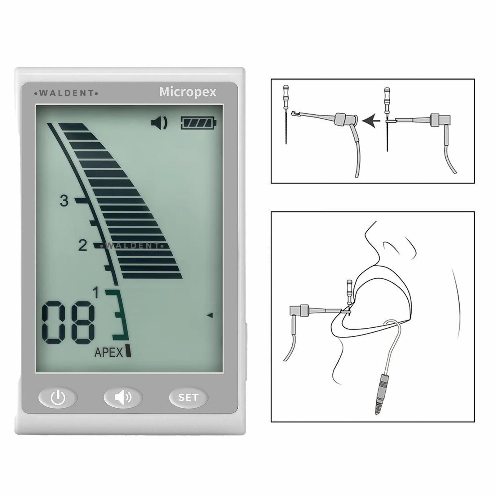 Waldent Micropex Apex Locator – Waldent.com