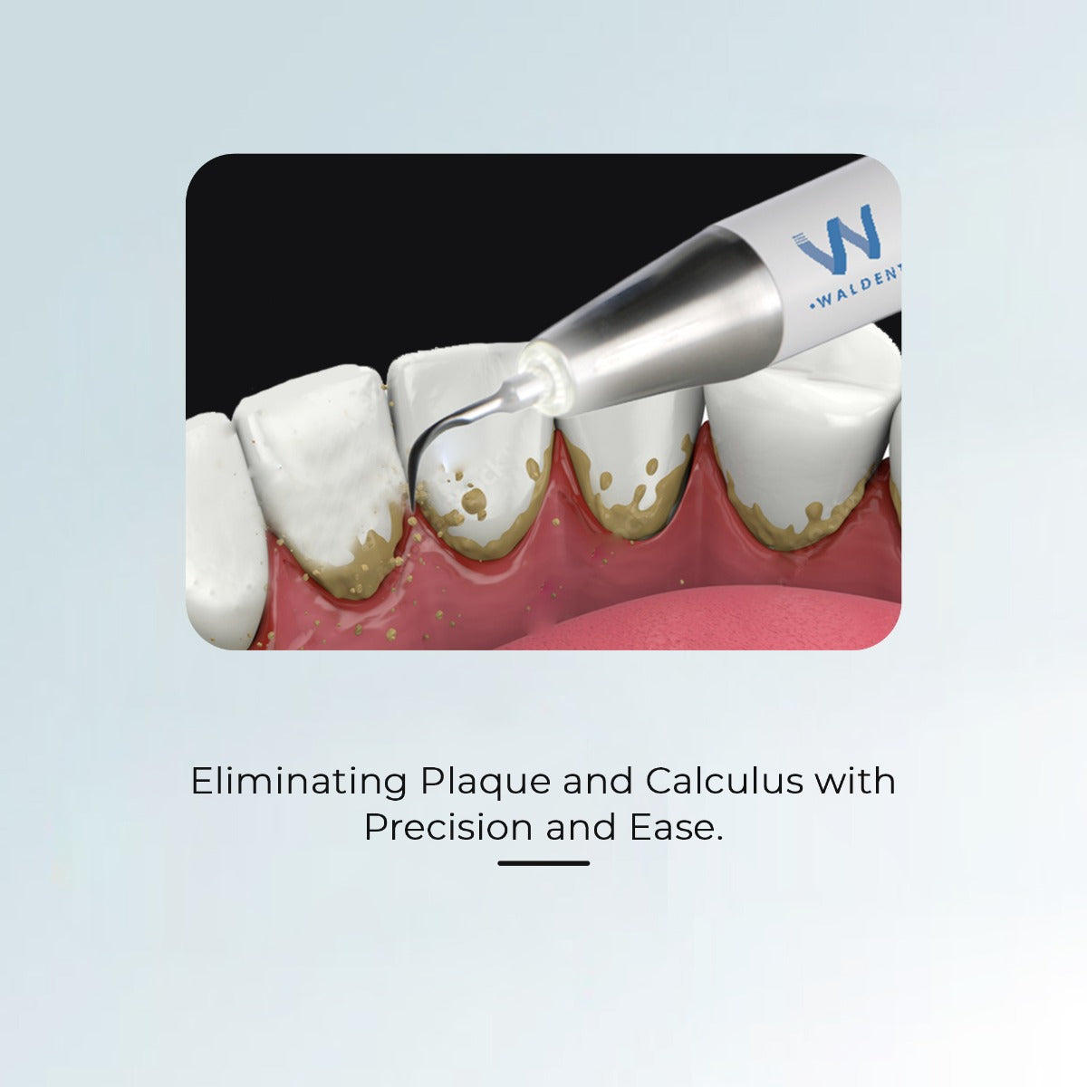 Waldent Ultrawave MaxPiezo 4 LED Ultrasonic Scaler – Waldent.com